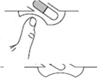 LENALIDOMIDE MYLAN 15 mg kemény kapszula | PHARMINDEX Online